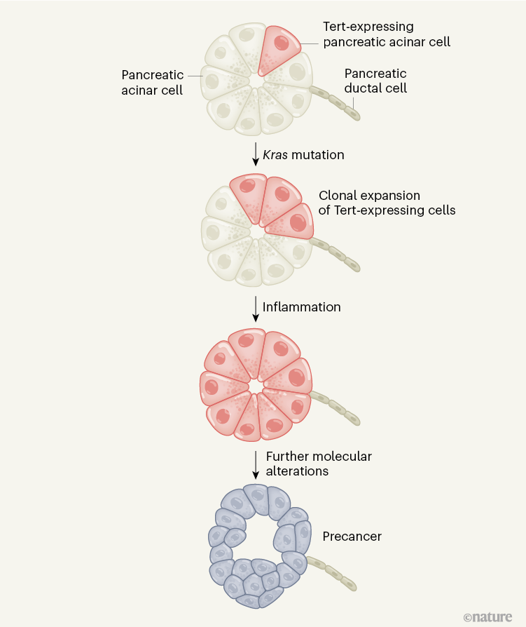 Insights into the origins of pancreatic cancer