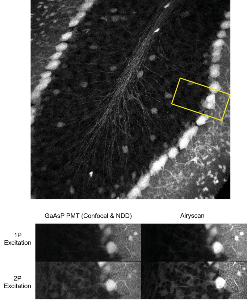 Application Note: Airyscan detection in multiphoton microscopy: super ...
