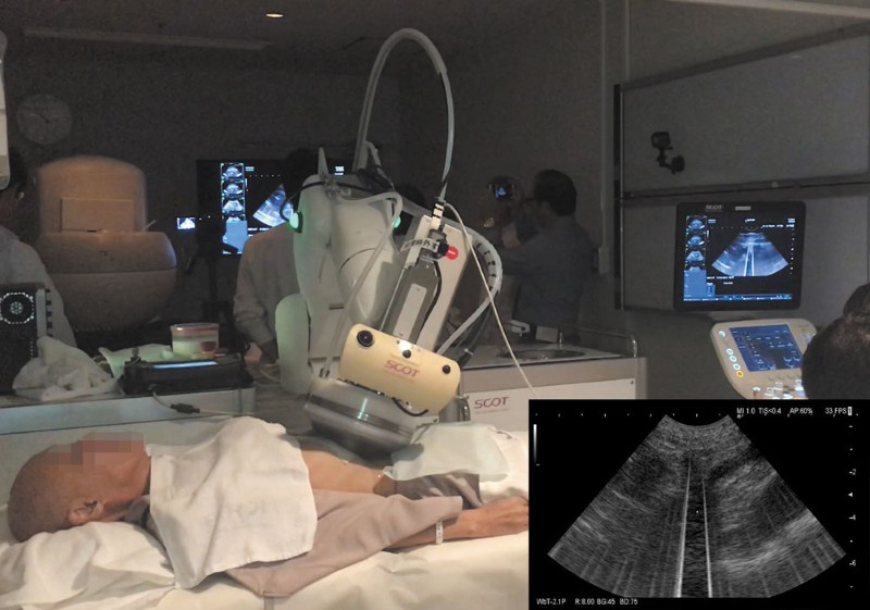 Ultrasound and nanobots — a deadly duo against cancer