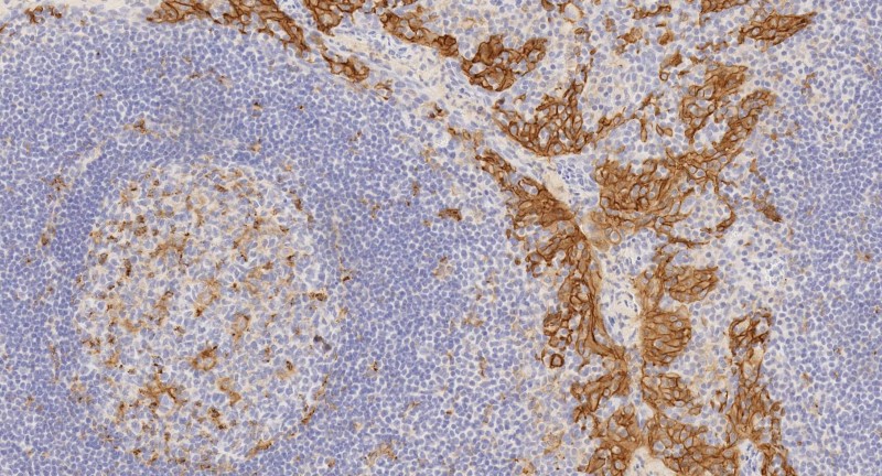 Unlocking the secrets of PD-L1 signalling