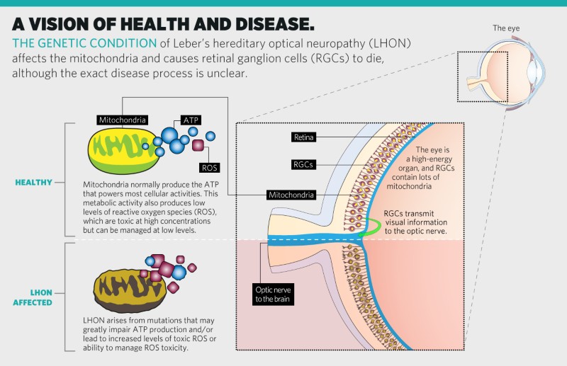 Eyeing opportunities to prevent vision loss