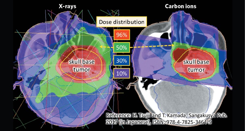 Radiotherapy redefined