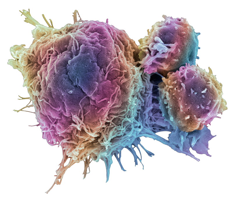 A detailed view of disease mechanisms