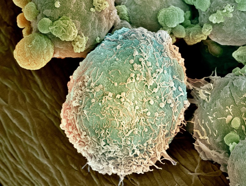 Single-cell multi-omics sheds light on the importance of tissue ...