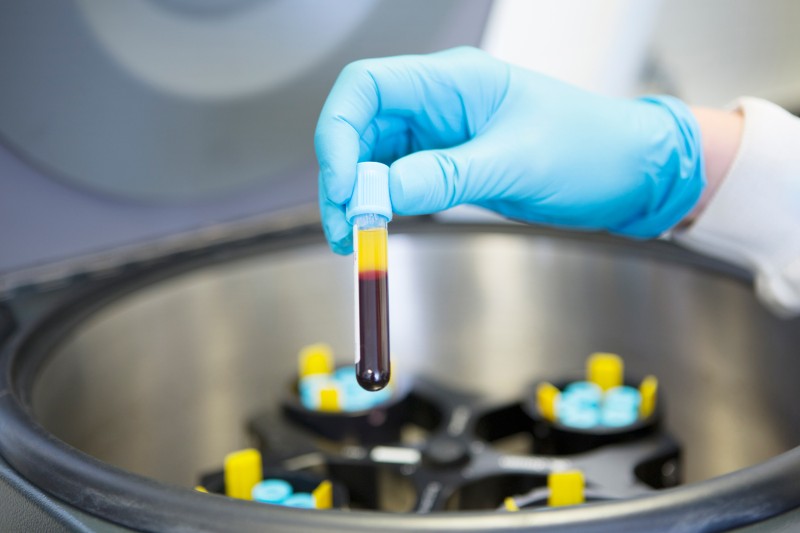 Detecting and monitoring cancer from blood samples