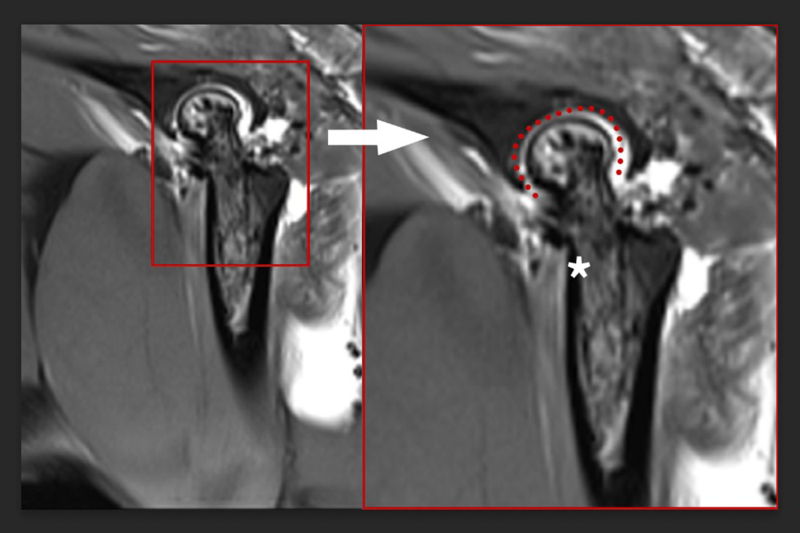 Taking the leap into a future of 3D-printed joints