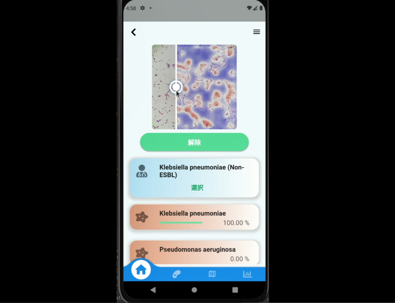Diagnosing bacterial infections using smartphones