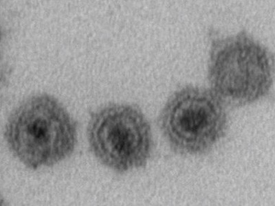 A non-tailed twist in the viral tale