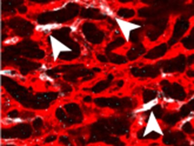 Coronary artery development, one cell at a time