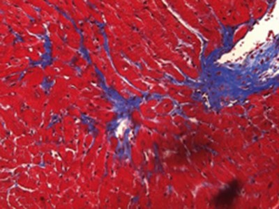 A mouse model for the most common form of heart failure