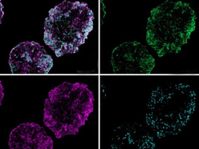 A map of β-cell differentiation pathways supports cell therapies for ...