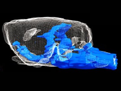 Lymphatic vessels at the base of the mouse brain provide direct ...
