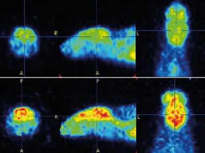 Moderation of neural excitation promotes longevity