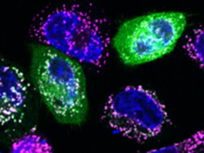 Mitochondrial distress call moves to the cytosol to trigger a response ...