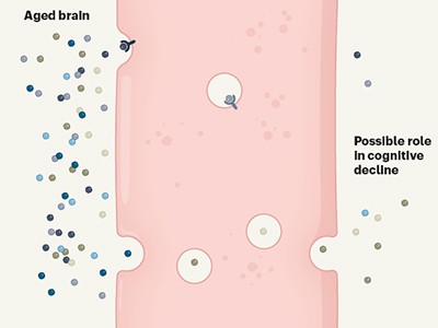 Private immune protection at the border of the central nervous system