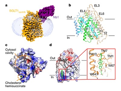 Transporter-protein structures show how salt gets a sweet ride into cells