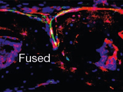 Dual stem-cell populations interact in the skull