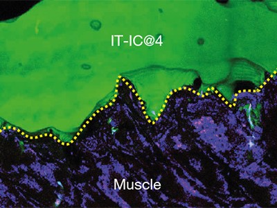 Hydrogel implant rehabilitates muscles through electrical stimulation