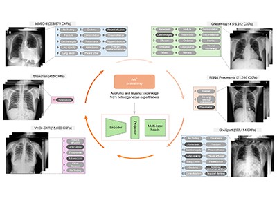 An open AI model could help medical experts to interpret chest X-rays