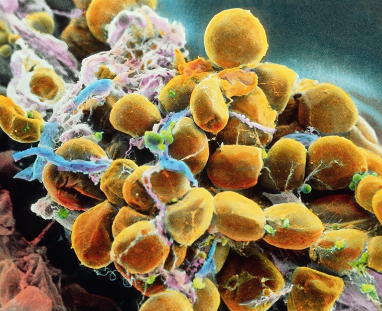 Turning up the heat on fat cells offers hope for treating obesity