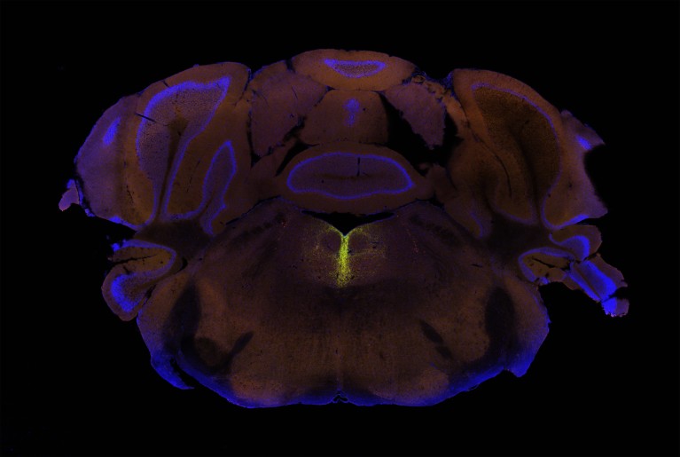 Brain region boosts avoidance of unpleasantness and pain — in mice