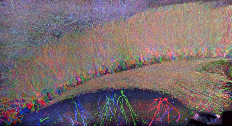 ‘Expansion microscopy’ turns ten: how a tissue-swelling method brought ...