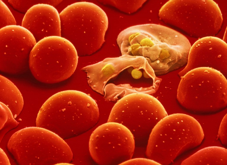 What if human blood were toxic to mosquitoes? A drug can make it so