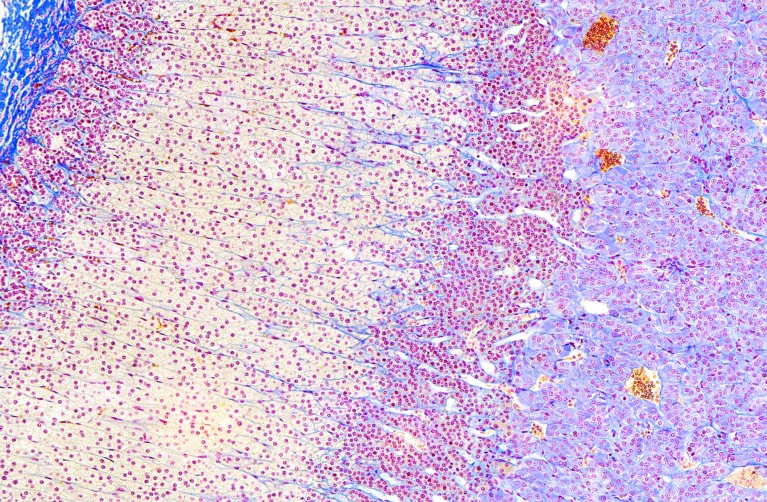 ‘Gland-in-a-dish’ secretes stress hormone like the real thing