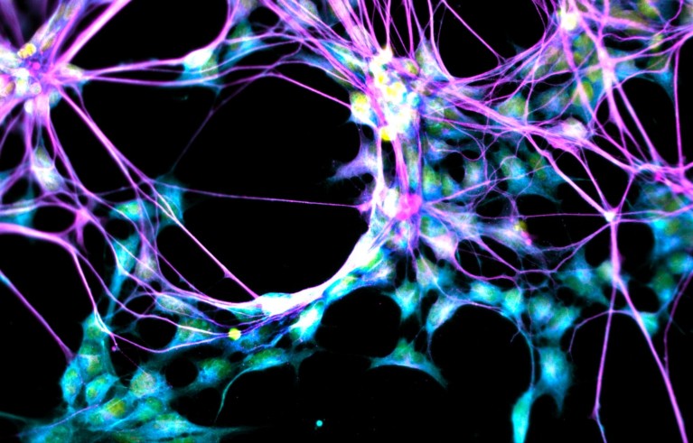 Brains of ‘super agers’ are strong producers of new neurons