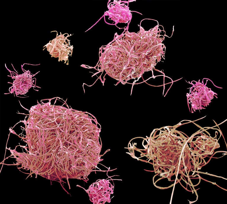 Brain tissue near tumours is loaded with plastic