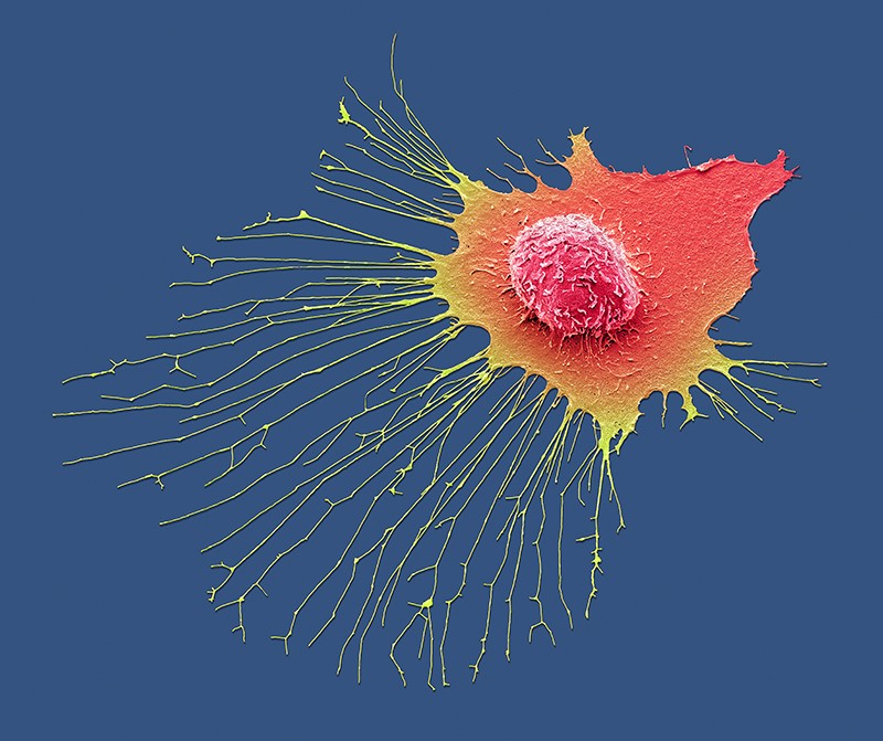 Cancer research with a human touch